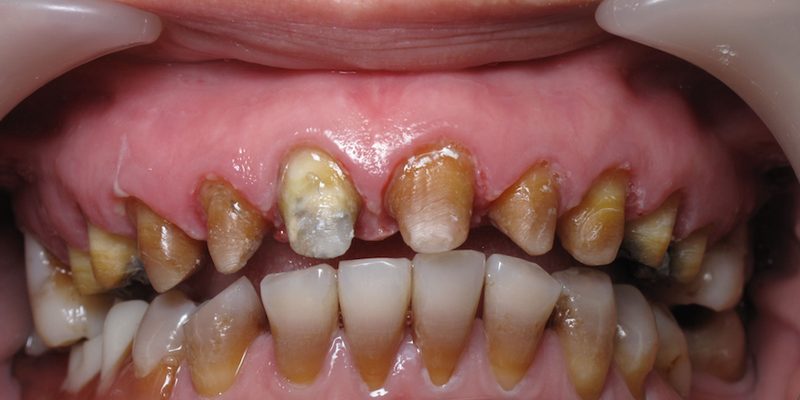 Digital Dental Lab | Intelligent Touch Dental Lab | Woodbury, MN